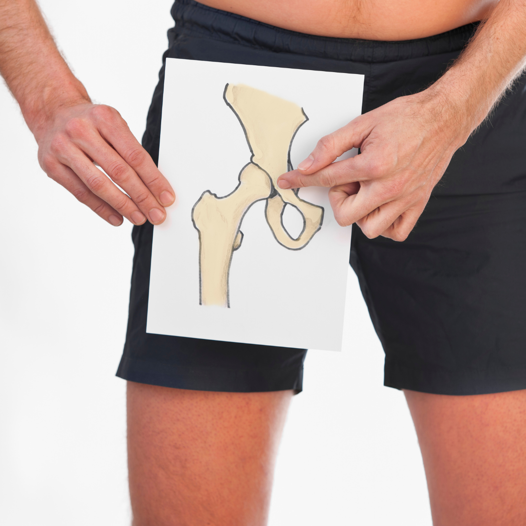 Hip Pain - Assessment, Diagnosis & Treatment - Chiro & Co.